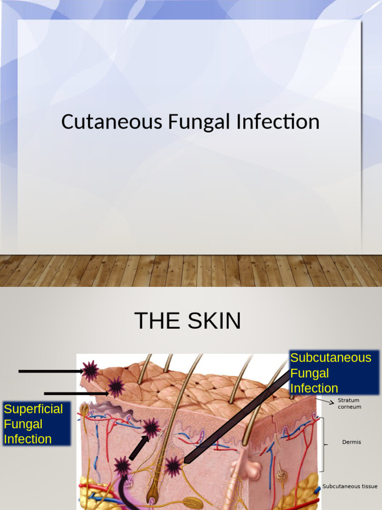 Superficial Fungal Infections Overview | PDF | Candidiasis | Mycology