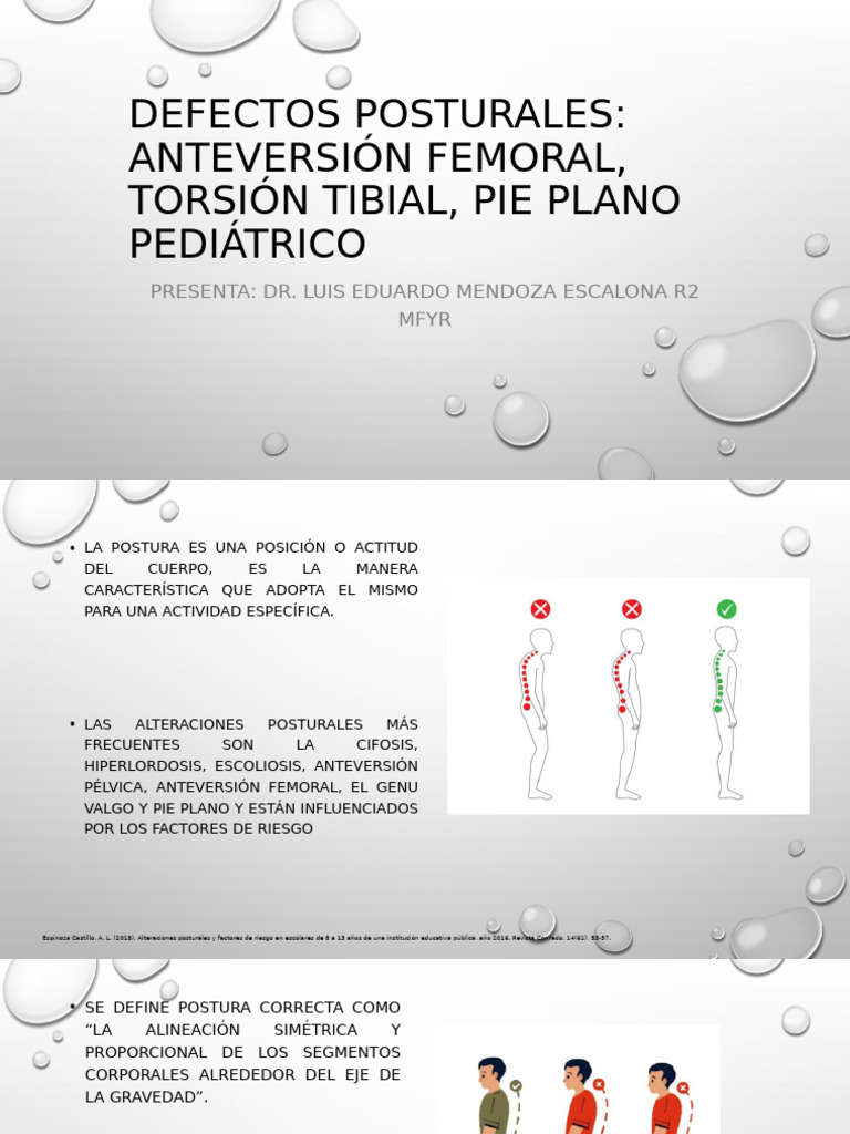 Defectos Posturales Anteversión Femoral, Torsión Tibial, Pie Plano ...