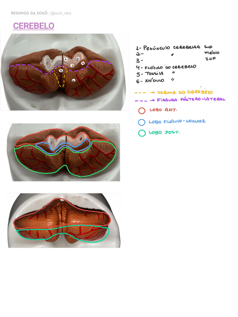 Roteiro Neuro 2 | PDF