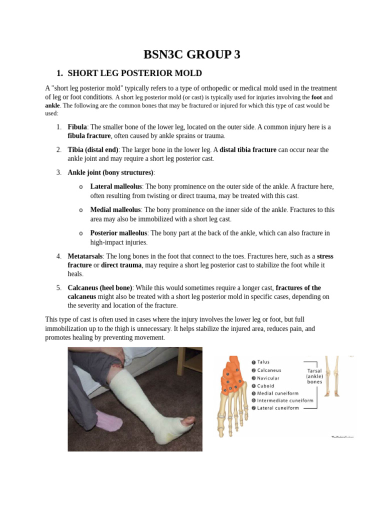 Types of Orthopedic Casts Explained | PDF | Knee | Ankle