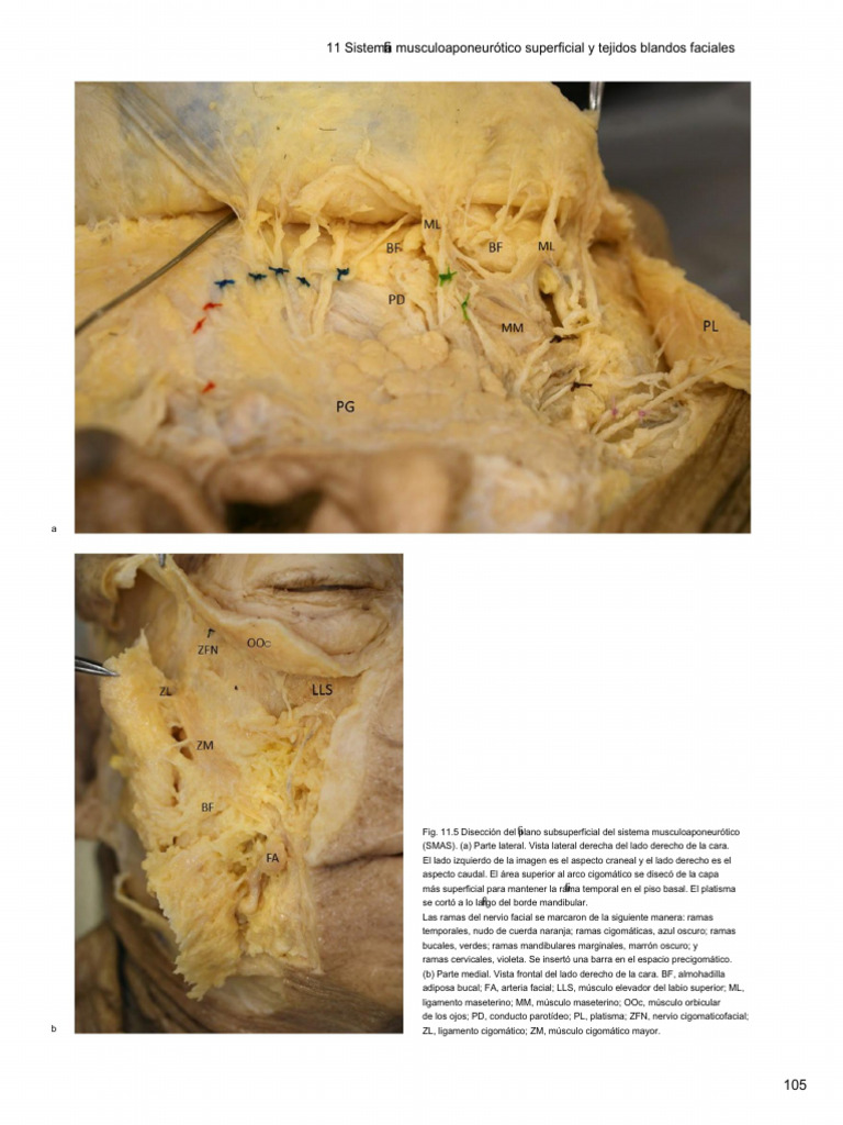 Anatomía del SMAS y nervio facial | PDF