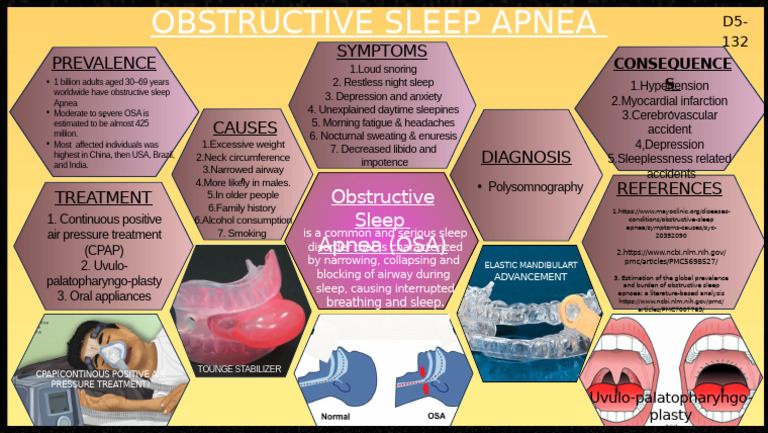OBSTRUCTIVE SLEEP APNEA | PDF | Sleep Apnea | Sleep Medicine