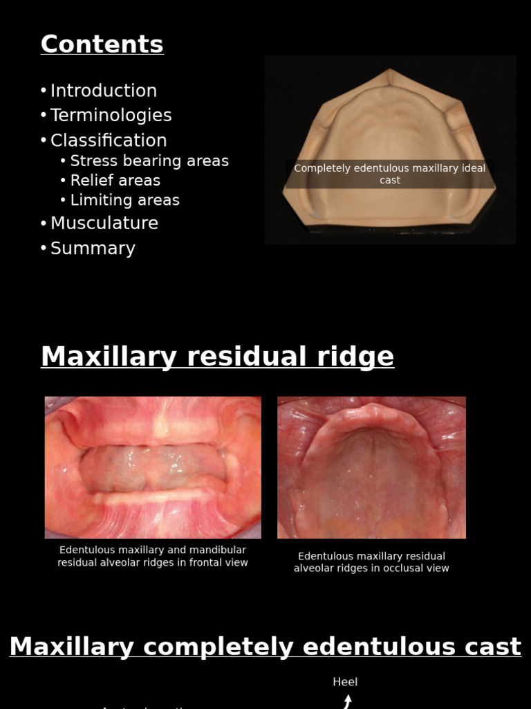 Maxillary Anatomical Landmarks | PDF | Dentures | Lip