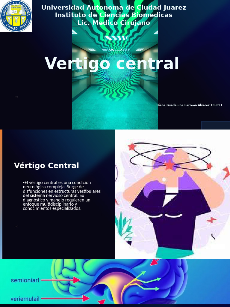 Vértigo Central: Causas y Diagnóstico | PDF | Migraña | Vértigo