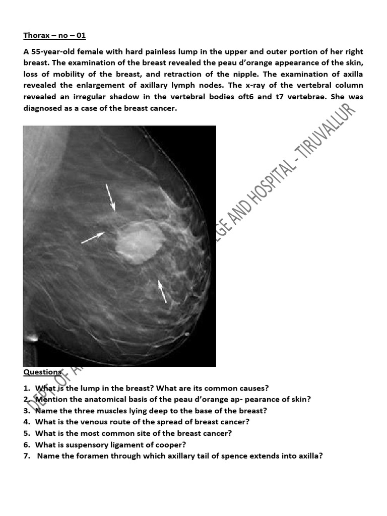 Thorax Clinical Charts | PDF | Aorta | Coronary Circulation