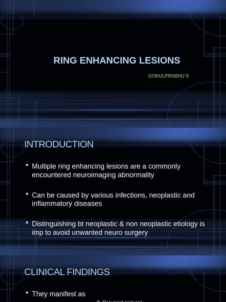 Ring Enhancing Lesions | PDF | Brain Tumor | Medical Specialties