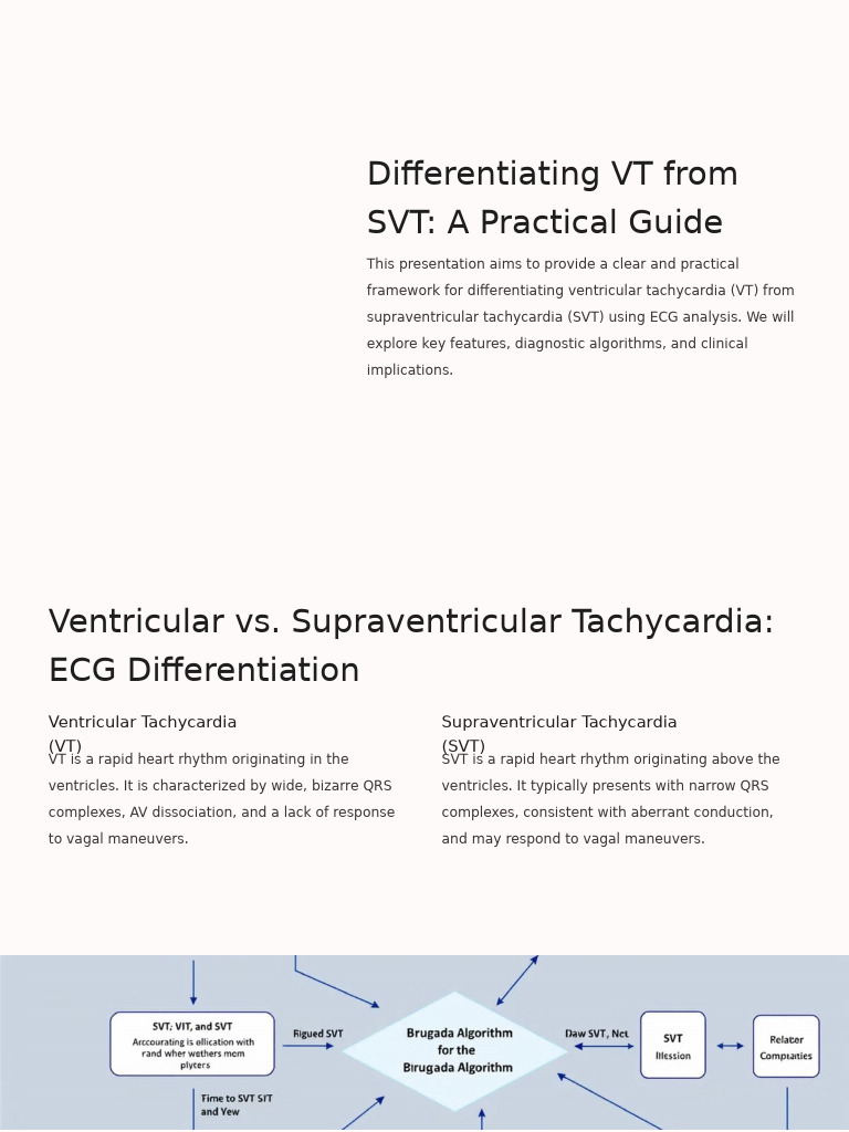 Differentiating VT From SVT A Practical Guide 1 | PDF ...