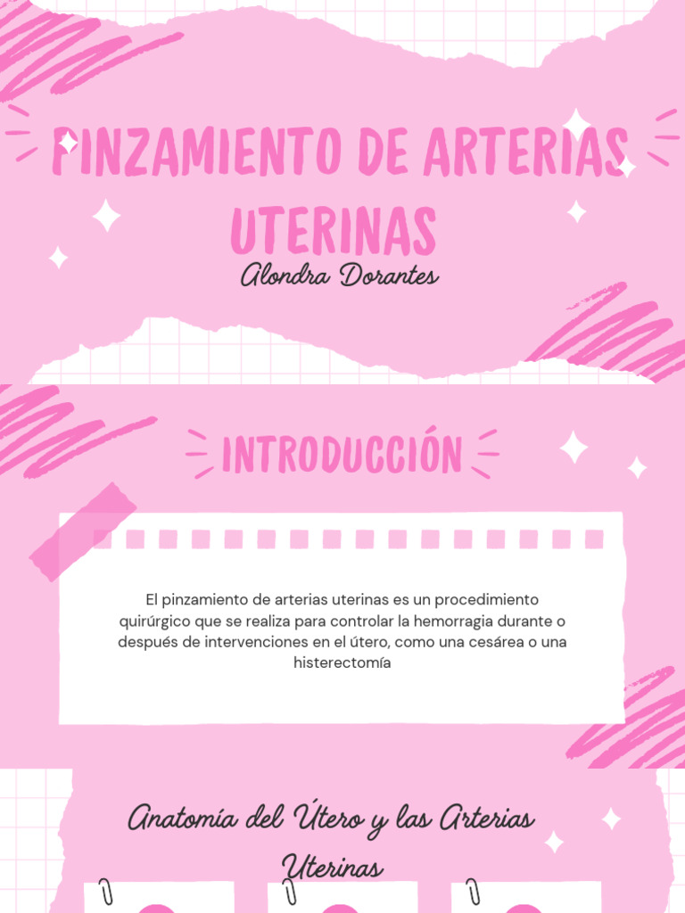 Pinzamiento de Arterias Uterinas | PDF | El embarazo | Útero