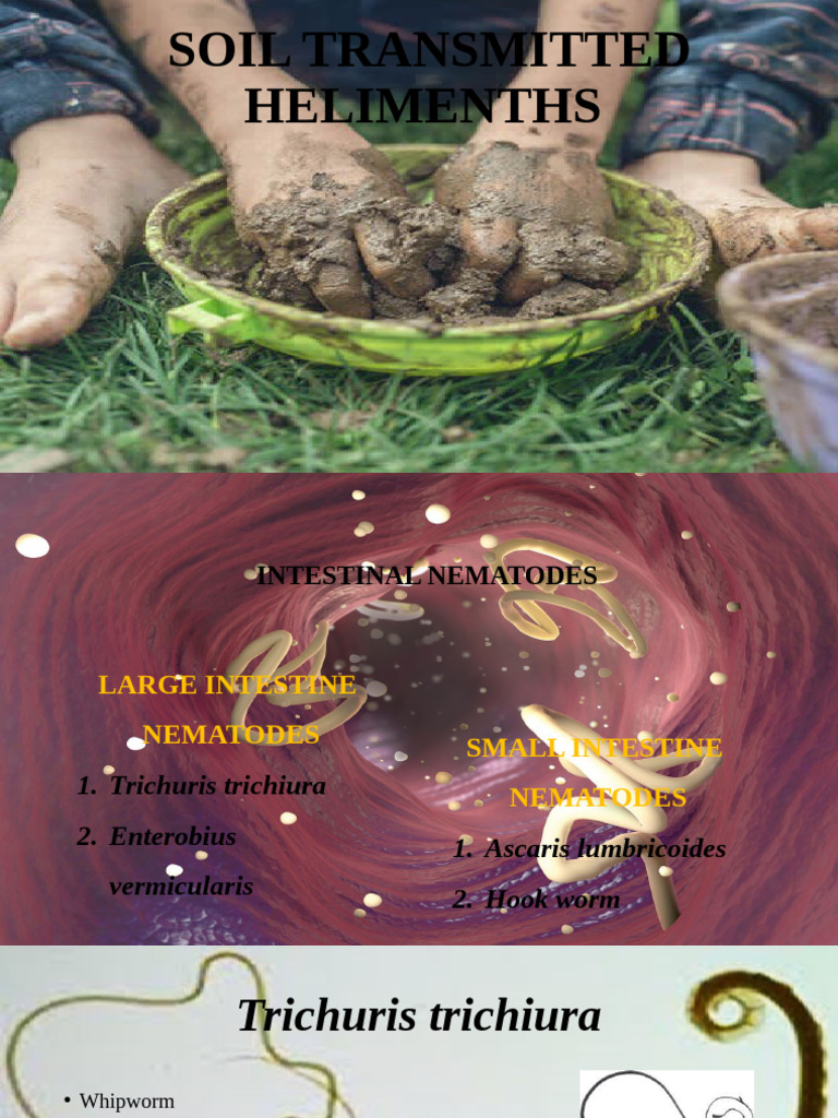 Soil Transmitted Helimenths | PDF | Microbiology | Human Diseases And ...