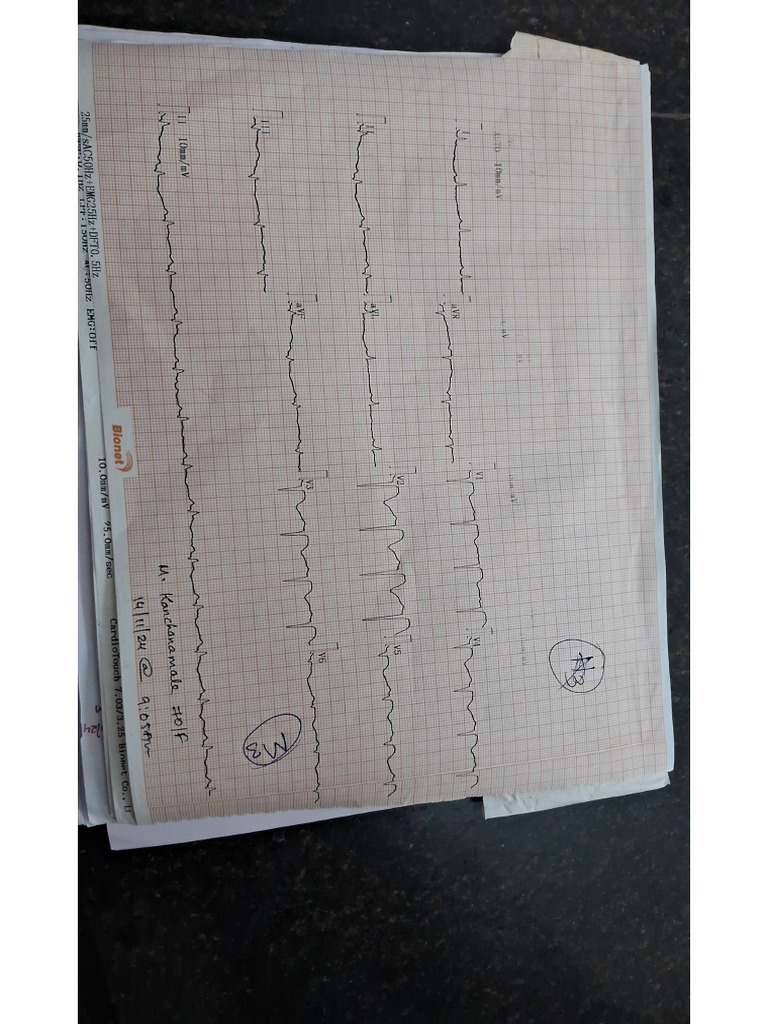 Cardio Case Sheets | PDF
