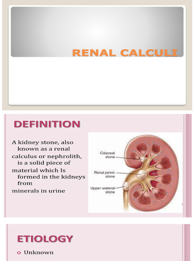 Renal Calculus | PDF