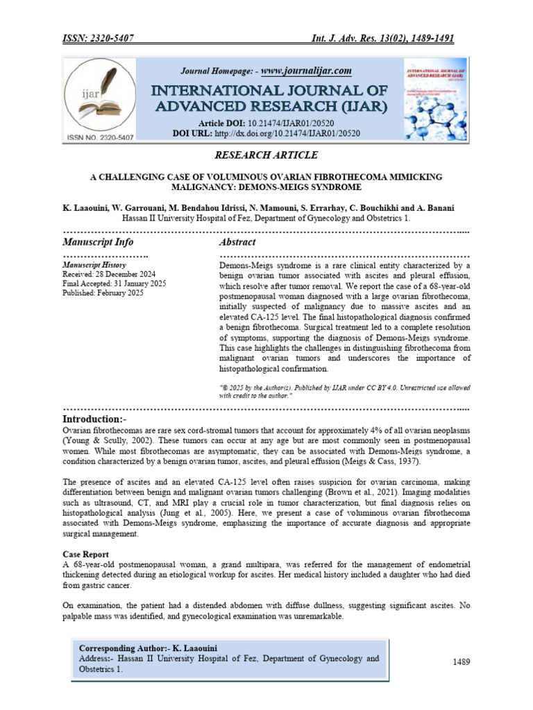 A CHALLENGING CASE OF VOLUMINOUS OVARIAN FIBROTHECOMA MIMICKING ...