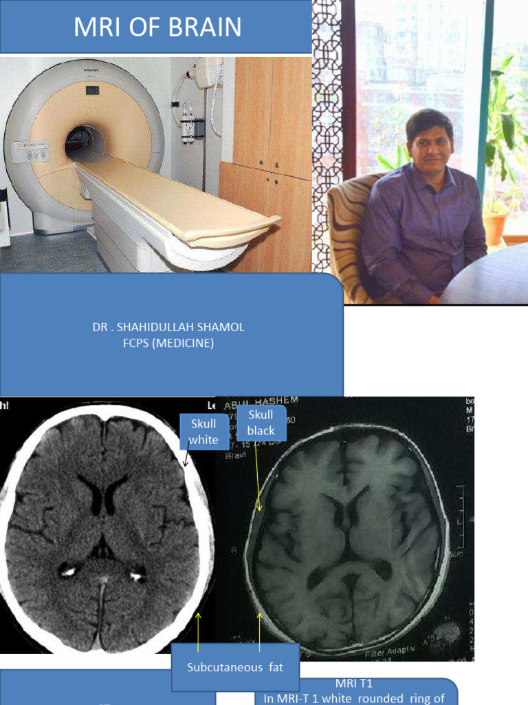 MRI Brain Imaging Techniques Explained | PDF | Brain Tumor | Nervous System