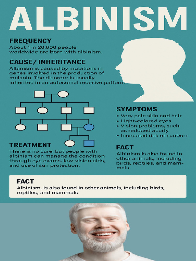 Albinism Infographic - Arda Yatçı | PDF