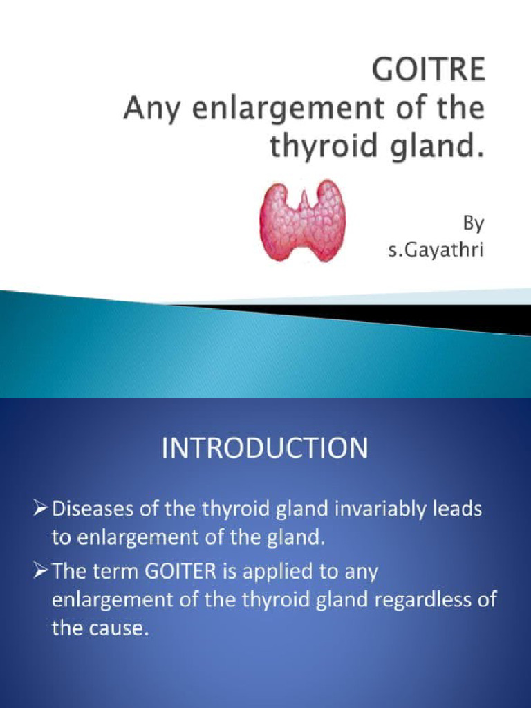 GOITER | PDF
