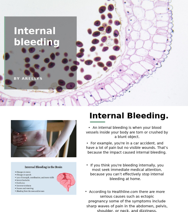 Internal Bleeding | PDF