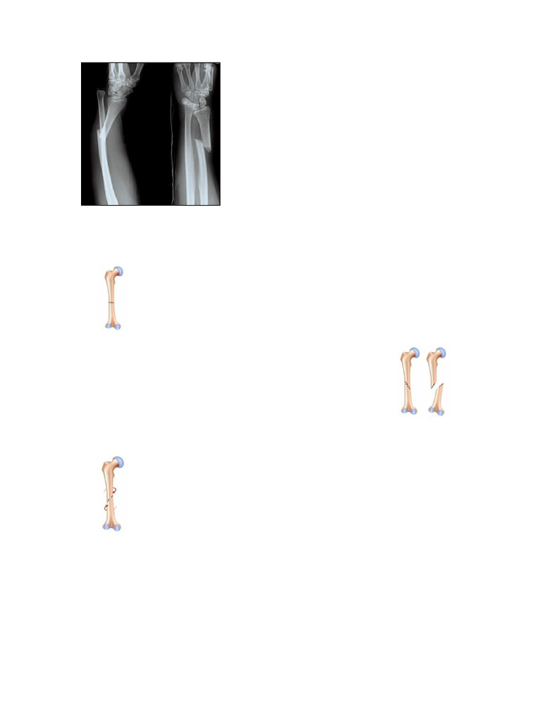 Anatomia, Iverson | PDF | Dolor | Músculo