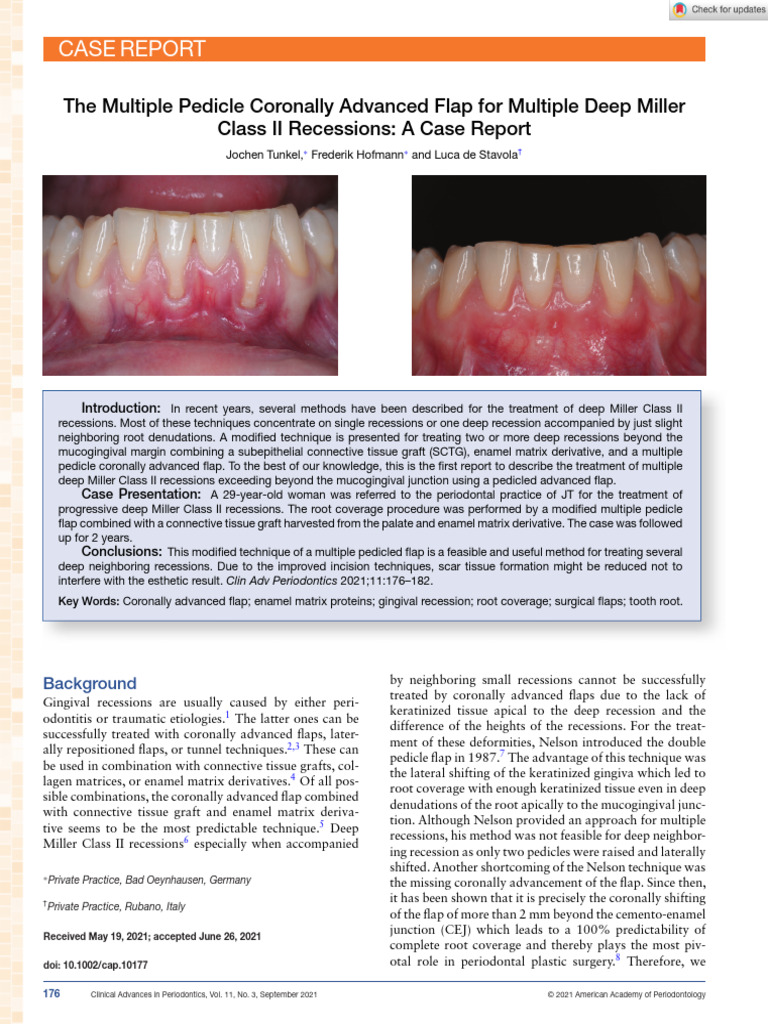 Clin Adv Periodontics - 2021 - Tunkel - The Multiple Pedicle Coronally ...