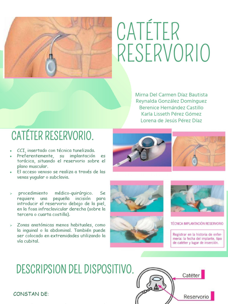 Cuidados y Técnica de Catéter Reservorio | PDF | Terapia intravenosa ...