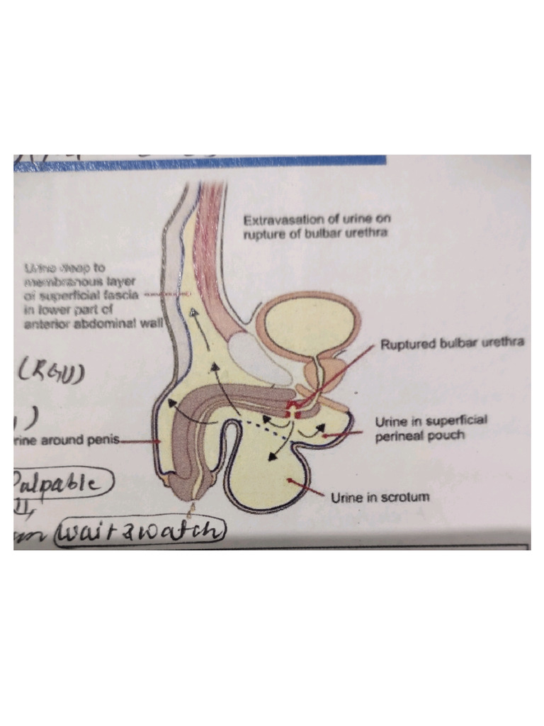Urethral Trauma | PDF
