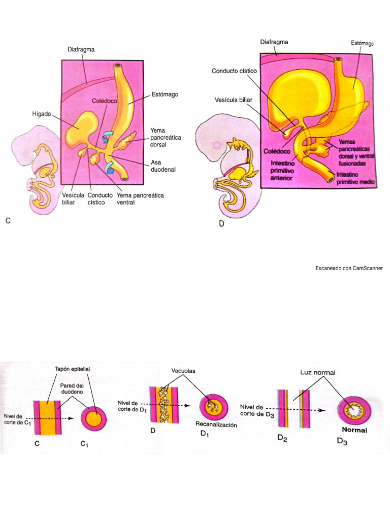 Duodeno Embrio | PDF