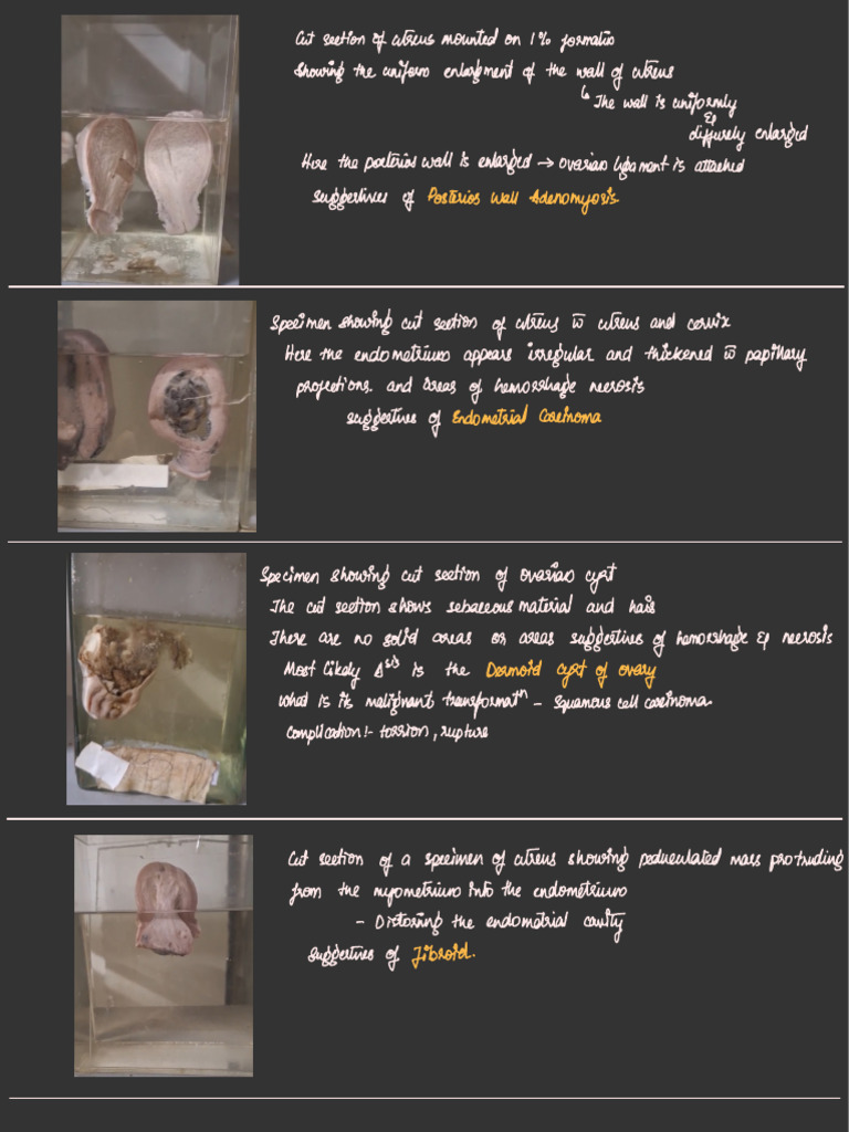 OBG Specimens. | PDF | Uterus | Ovarian Cancer