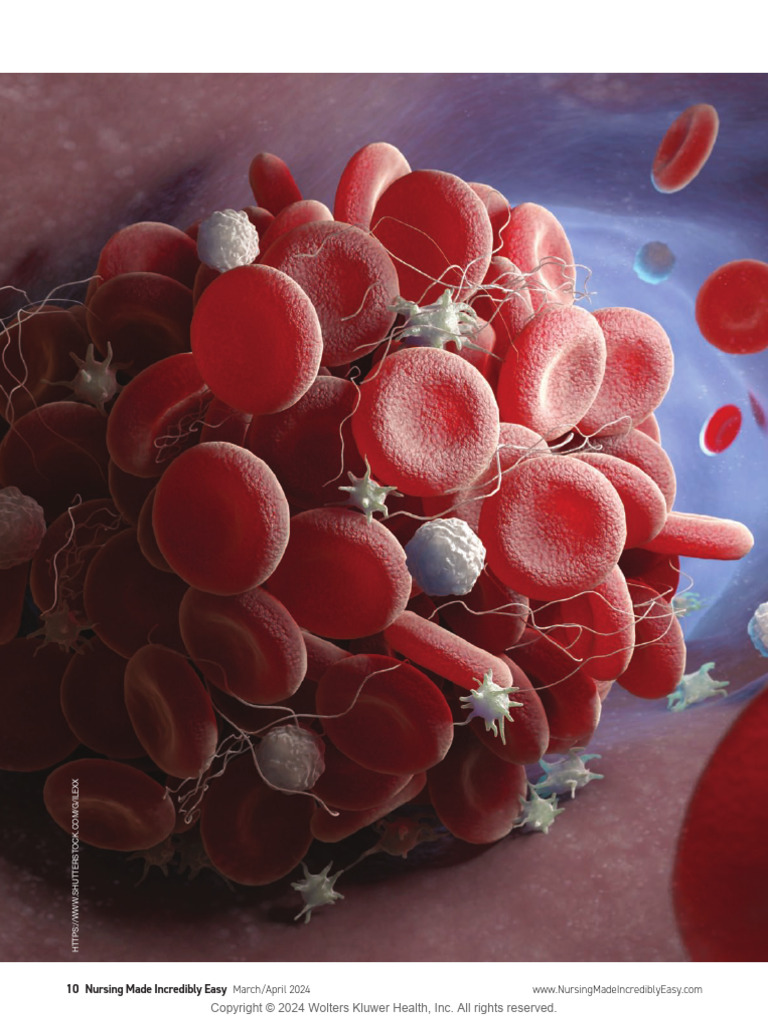 Antiphospholipid Syndrome: Nursing Insights | PDF | Medicine | Diseases ...