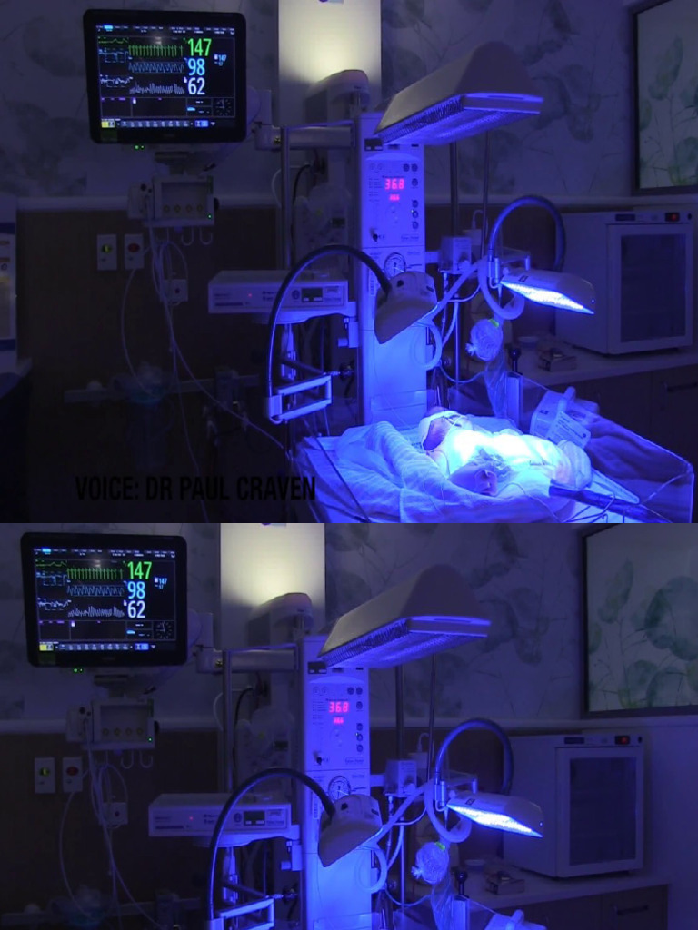 Phototherapy | PDF