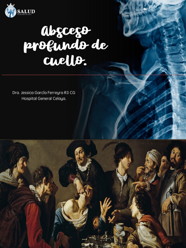 Manejo del Absceso Profundo de Cuello | PDF | Especialidades Medicas ...