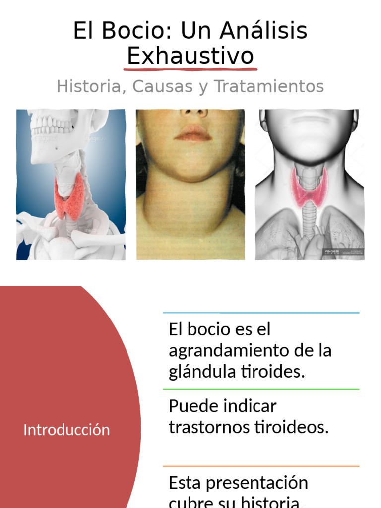 Bocio: Causas, Síntomas y Tratamientos | PDF