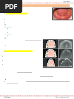Class IV Kennedy Removable Partial Denture | PDF | Dentures | Mouth