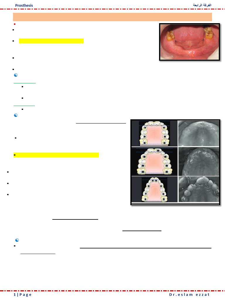 Kennedy Class IV Prosthesis Overview | PDF | Dentures | Dentistry