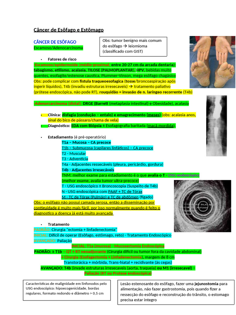 Tilose Palmoplantar e Câncer Digestivo | PDF | Câncer de esôfago | Esôfago