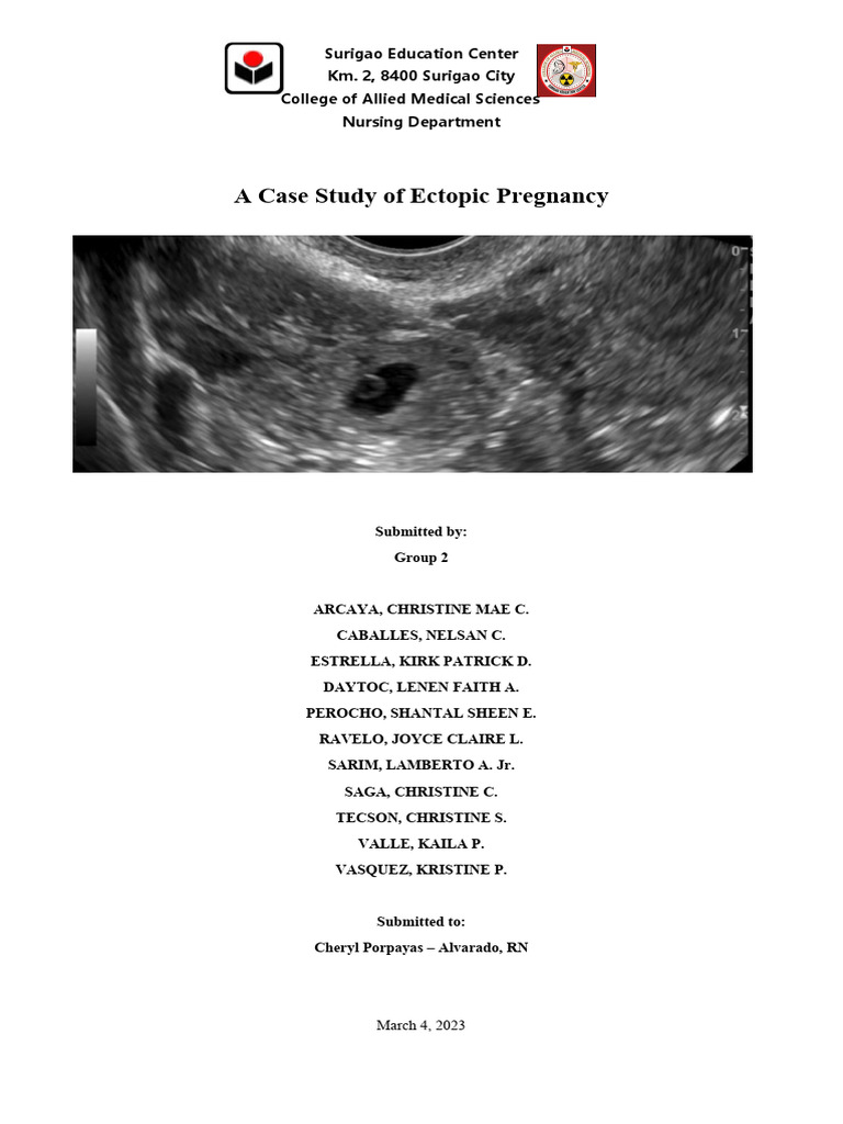 A Case Study of Ectopic Pregnancy | PDF | Uterus | Pregnancy