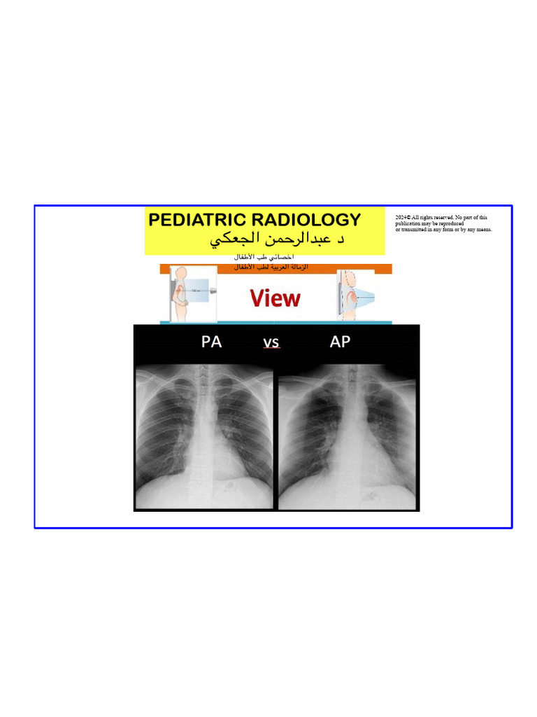 Pediatric Chest X-Ray Interpretations | PDF | Pneumonia | Medical ...