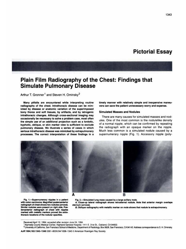 Ominsky Gronner 2013 Plain Film Radiography of The Chest Findings That ...