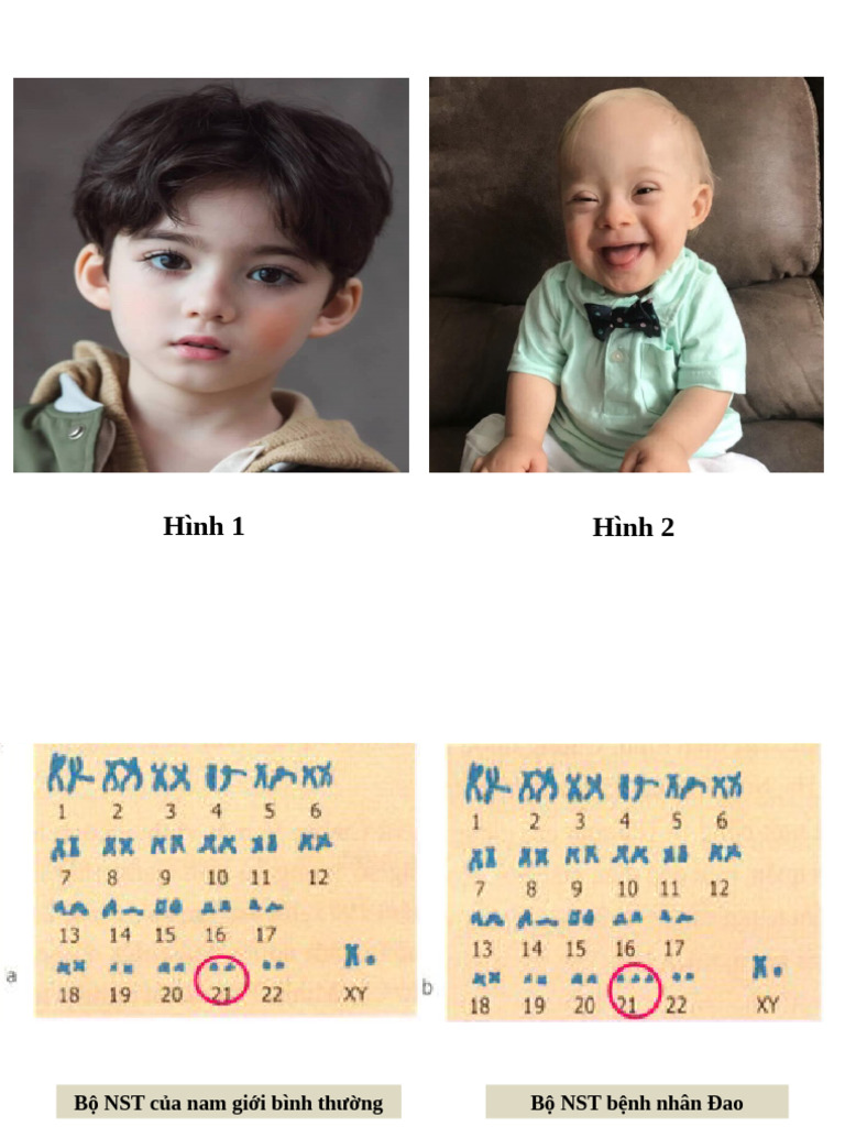 Bai 23 Dot bien so luong nhiem sac the | PDF