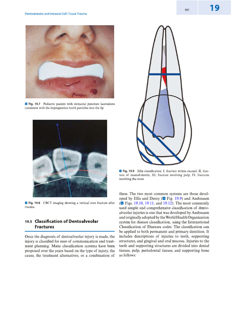 Clasificacion Andreasen | PDF