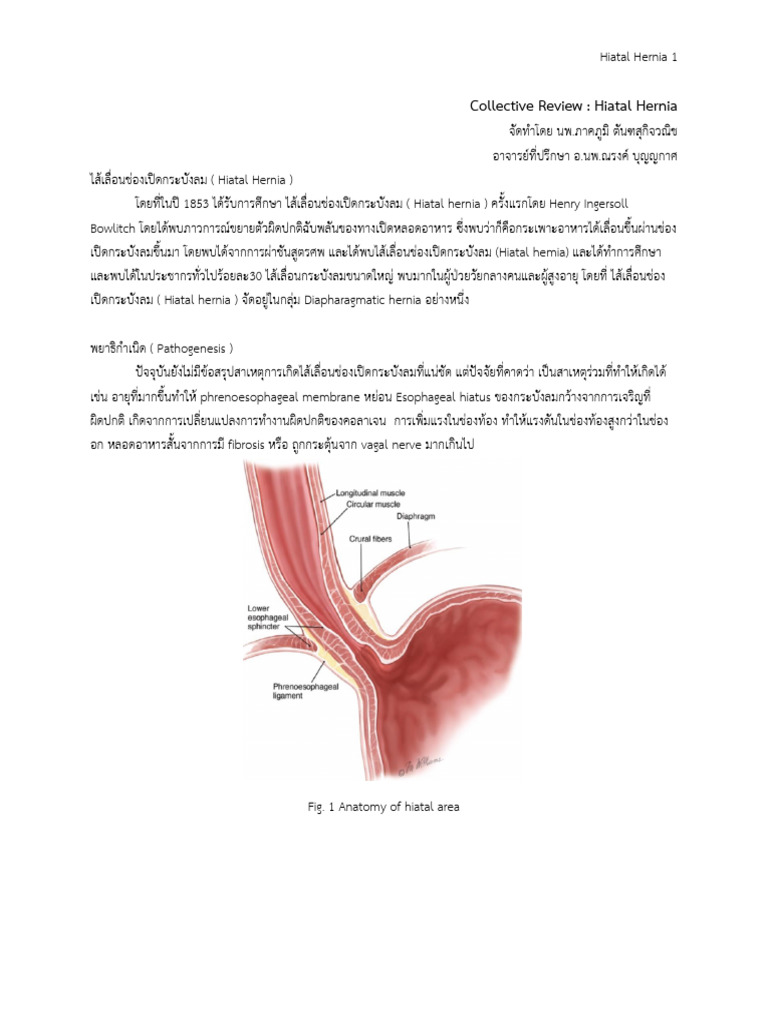 Hiatal Hernia | PDF