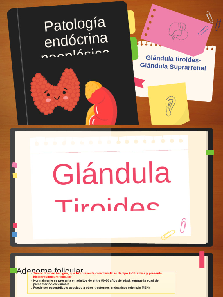 Tiroides-Suprarrenal - PPTX 20250402 162232 0000 | PDF | Neoplasias ...