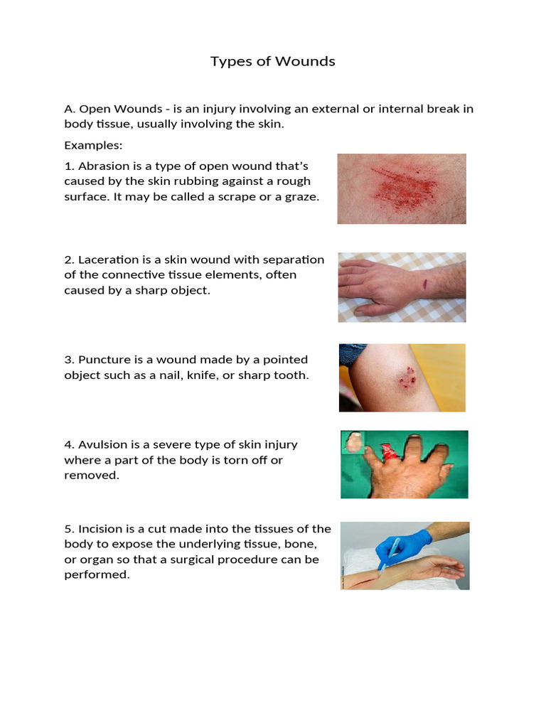 Types of Open and Closed Wounds | PDF