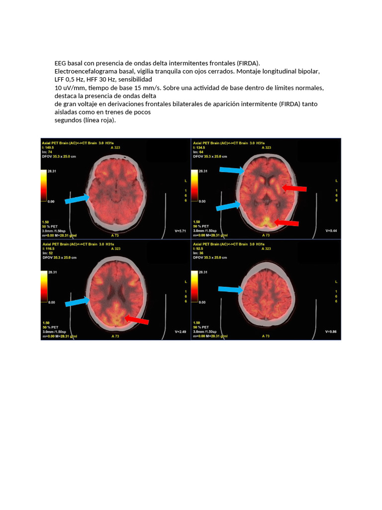 EEG Base | PDF