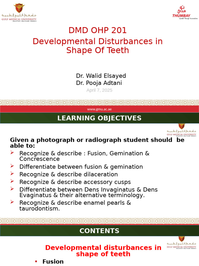 Developmental Disturbances in Shape of Teeth | PDF | Dental Anatomy | Tooth