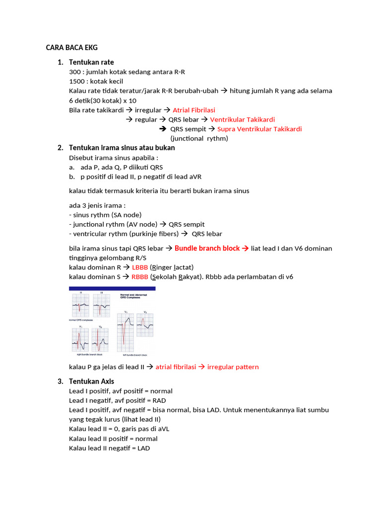 348 - Cara Baca Ekg | PDF