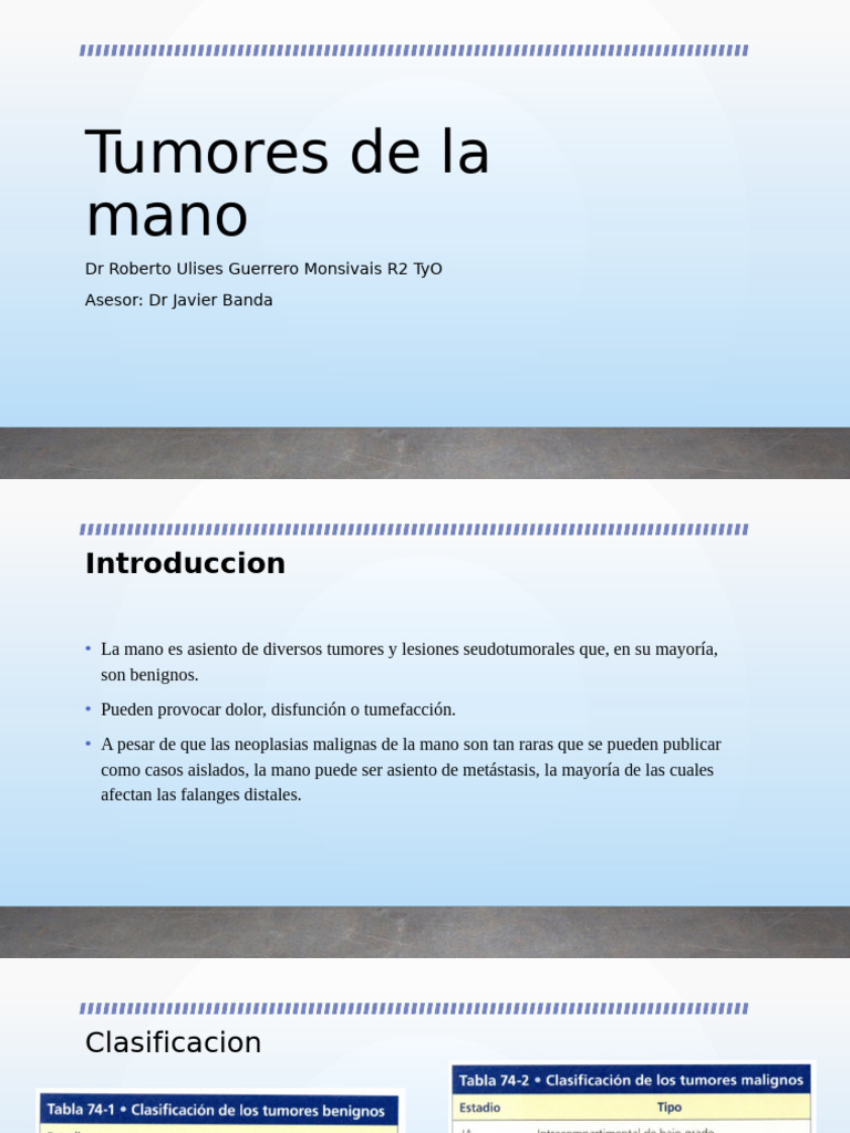 Tumores de Mano | PDF | Neoplasias | Sarcoma