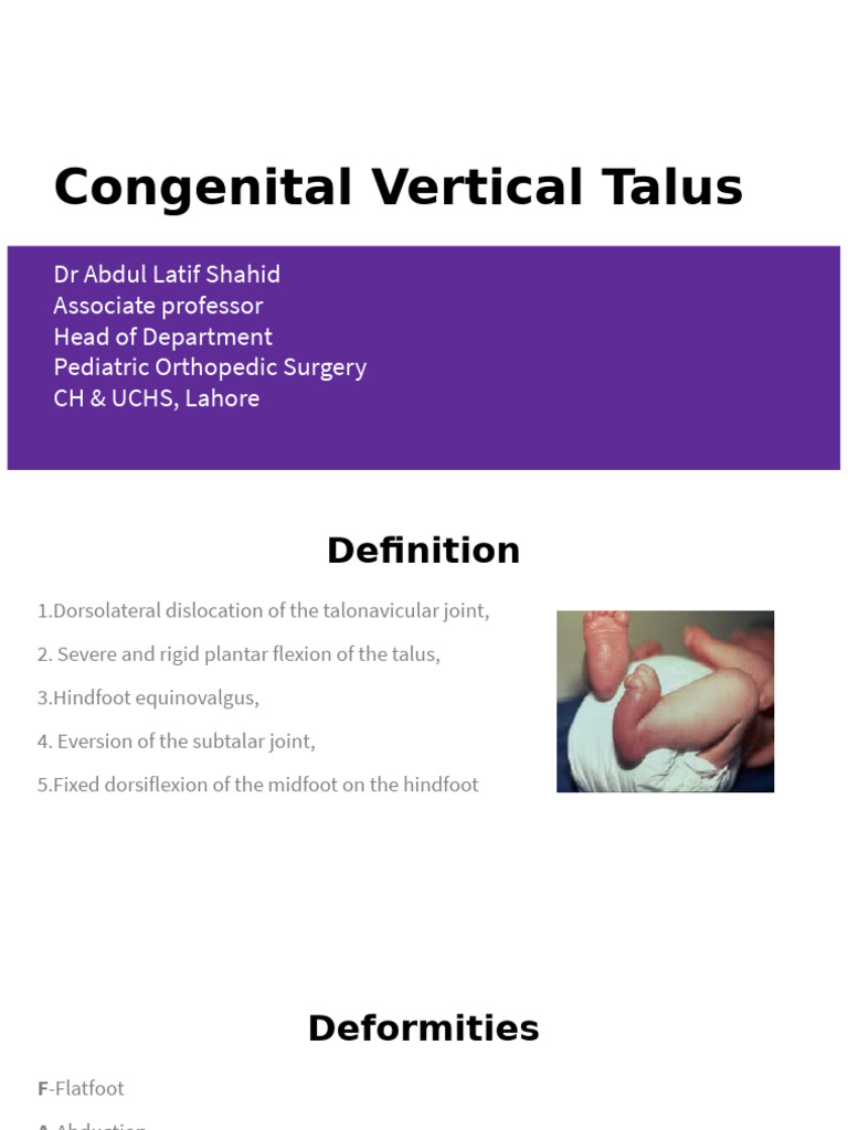 Congenital Vertical Talus Overview | PDF | Foot | Ankle