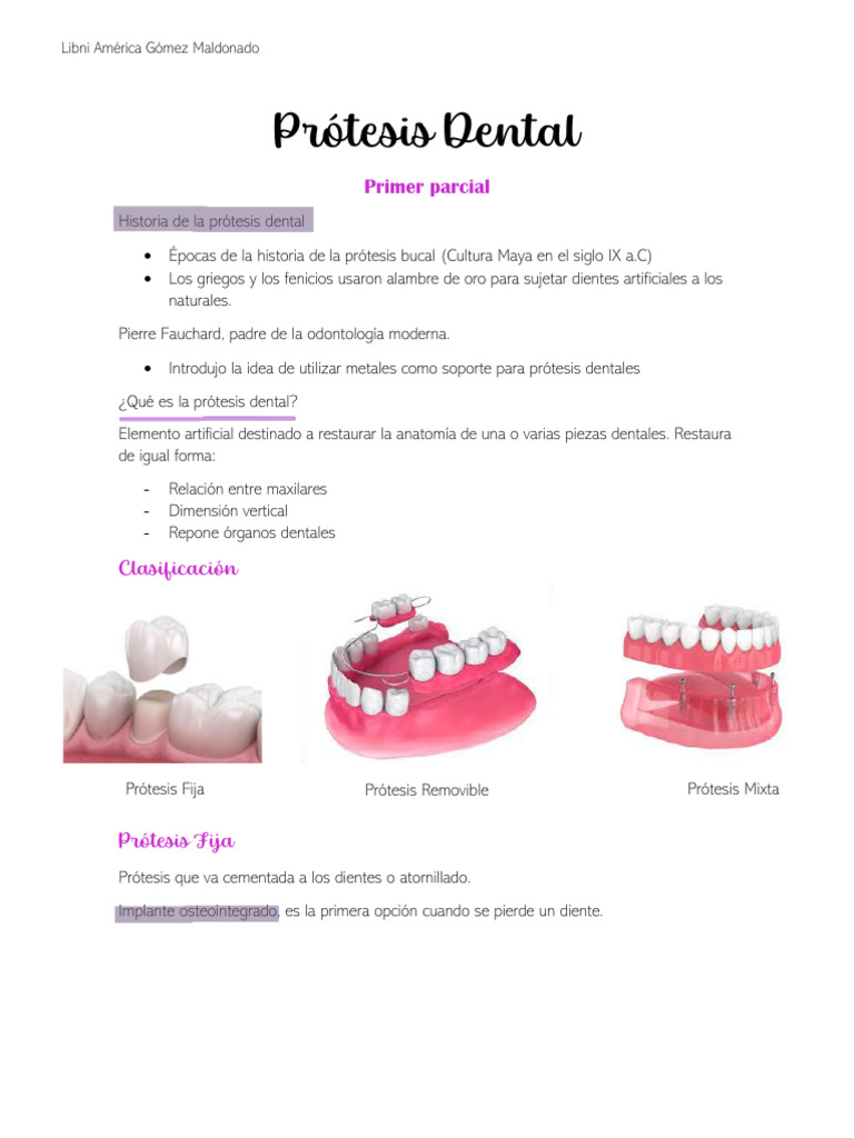 Historia y Tipos de Prótesis Dental | PDF | Odontología | Sólido