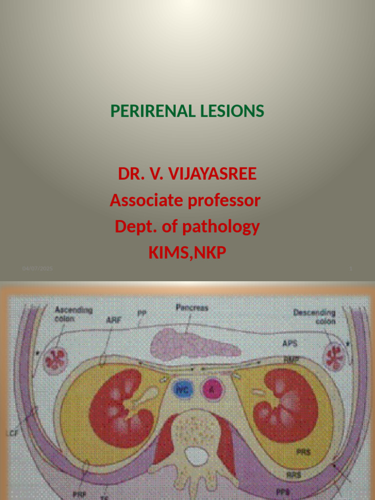 Perirenal Lesions, DR. V. VIJAYASREE | PDF | Diseases And Disorders ...