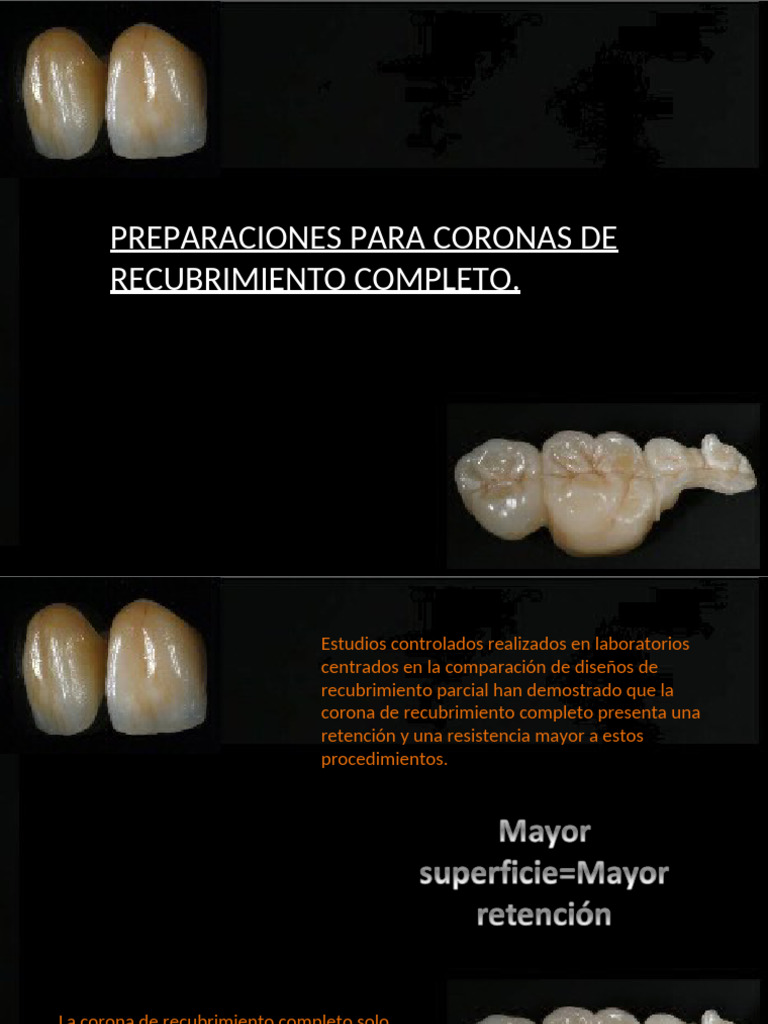 Preparacion de Coronas Totales | PDF