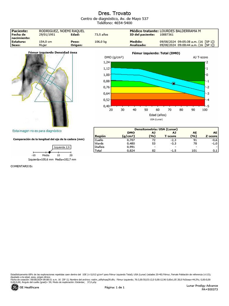 (DXA - ) Fémur Izquierdo Densitometría | PDF | Sistema esquelético